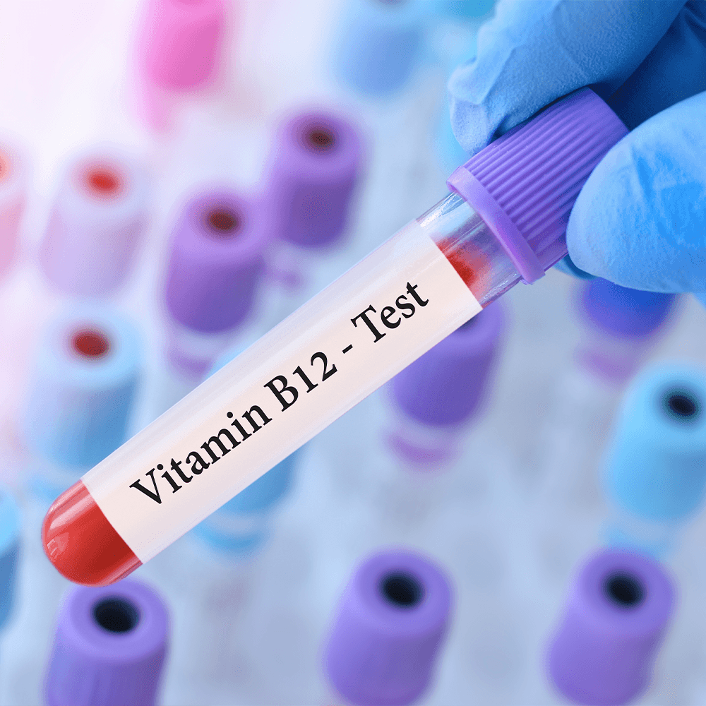 Book Vitamin B12 Test in UAE with myAster
