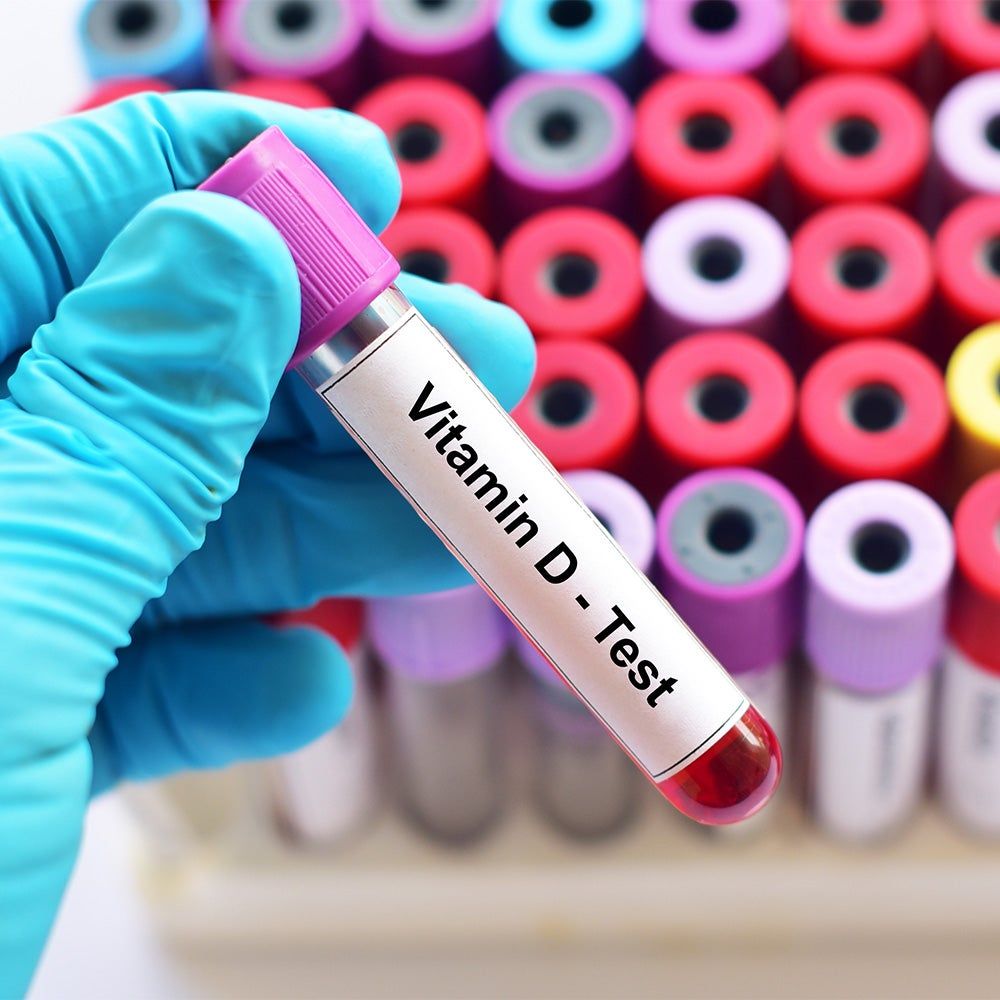 Book Vitamin D Test in UAE with myAster